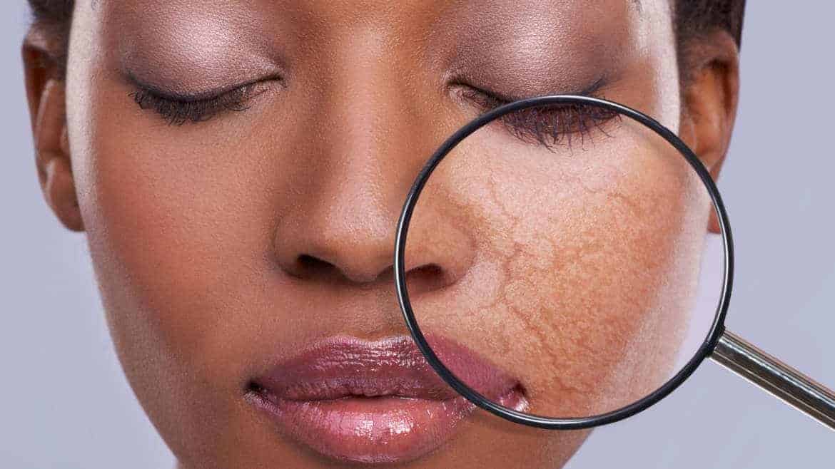 Wrinkle Reduction – InSkin Med Spa