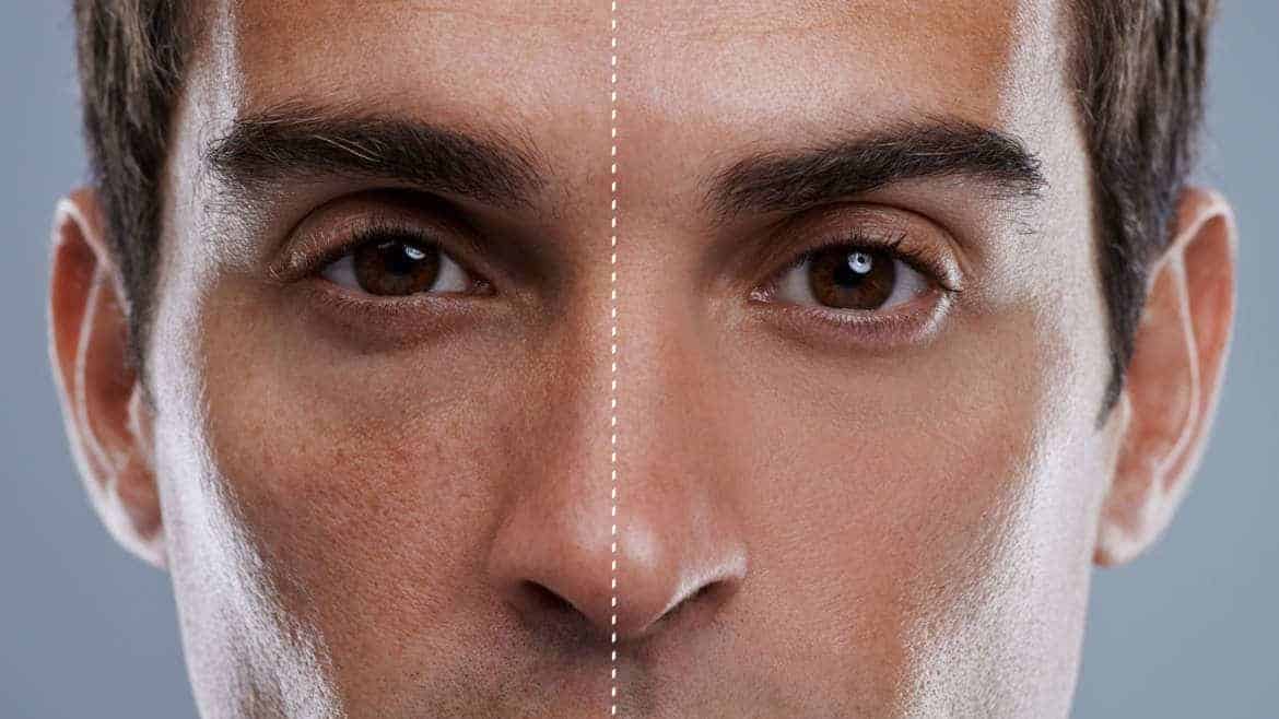 Color Correction – InSkin Med Spa