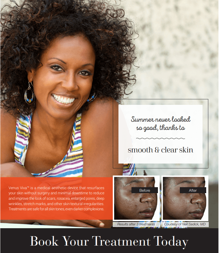 Venus_Viva_Facial_Clear_Skin – InSkin Med Spa